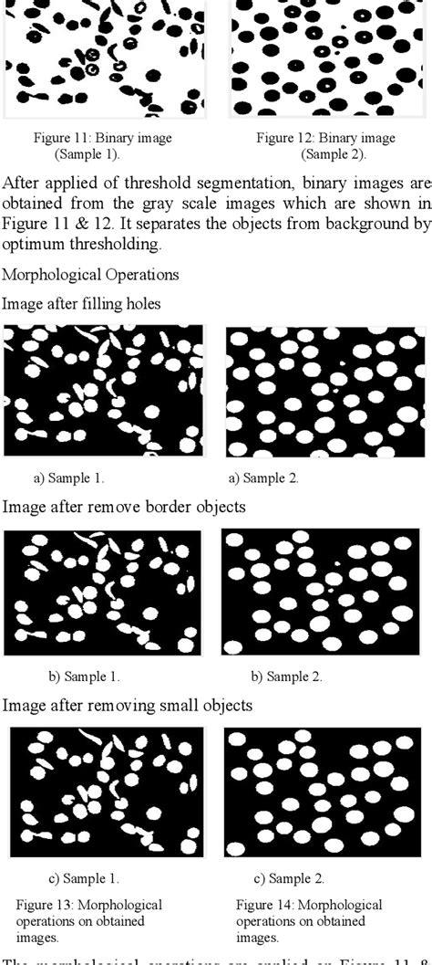 figure 11 from automatic sickle cell anemia detection using image