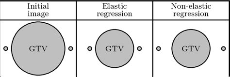 Schematic Illustration Of The Two Types Of Gtv Regression Download
