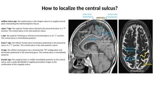 Anatomy Of Brain Ct And Mri Of Brain Pptx