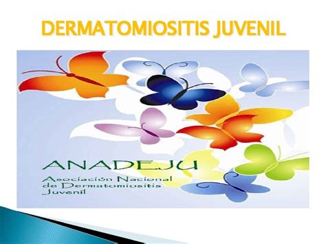 Dermatomiositis Juvenil Dermatomiositis Juvenil 1 Qu Es La