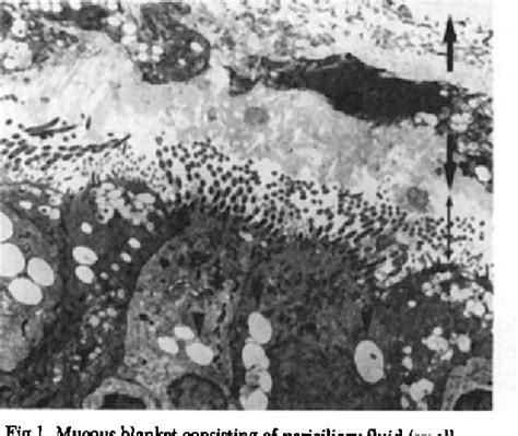 What Is The Primary Component Of The Mucous Blanket In The
