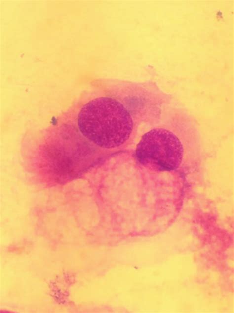 Ciliated Cell And Goblet Cell Obtained By Nasal Scraping Stained By Download Scientific