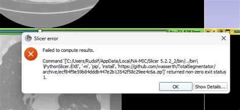 Total Segmentor Lung Basic Bug Report On Version 522 While Working