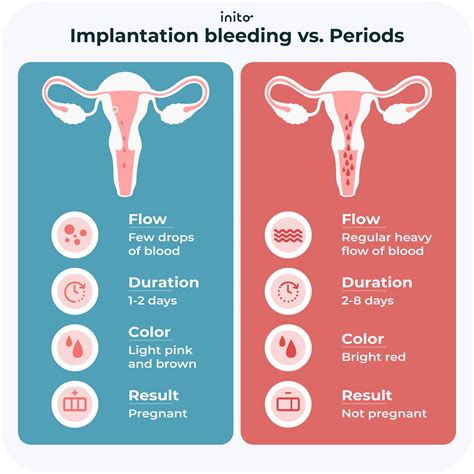 What Does It Mean When You Have White Creamy Discharge While Pregnant