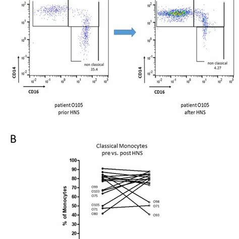 Flow Cytometric Analysis Of Monocyte Subsets Monocyte Measurements