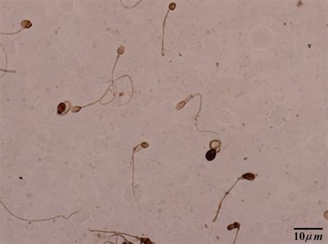 TUNEL Staining Brown Stained Sperm Shows Apoptosis Light Colored Download Scientific Diagram