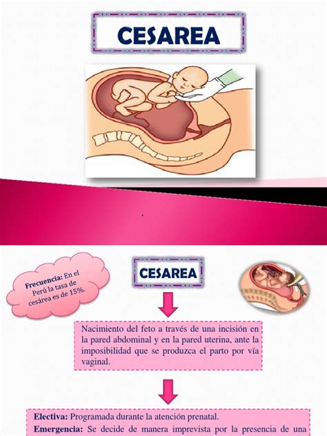 Indicaciones Y Procedimientos De Cesárea Pdf Parto La Salud De La
