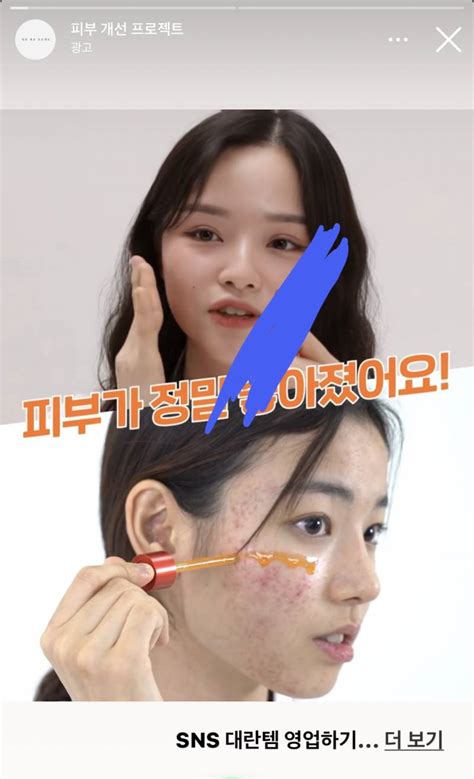 피부 안좋아도 예쁠사람은 인스티즈 Instiz 일상 카테고리
