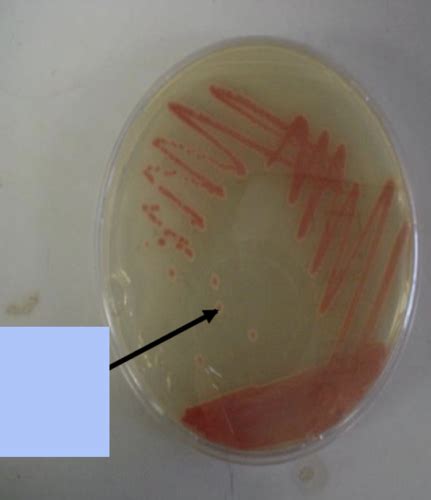 351 Lab Concepts 3 Flashcards Quizlet