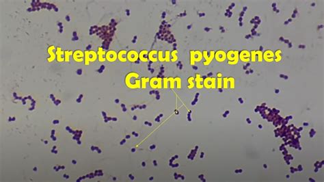 Streptococcus Pyogenes Gram Stain