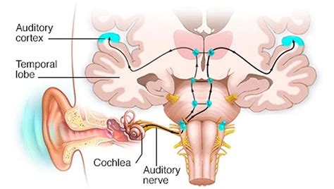Auditory Cortex Auditory Area Of Brain Location And Function