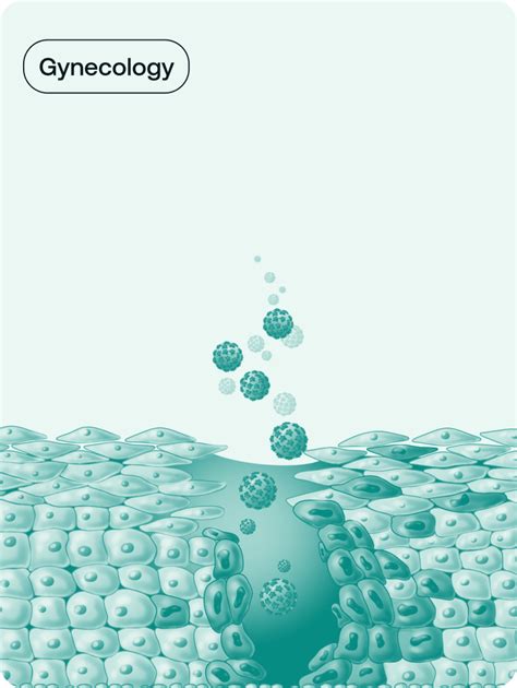 Adjuvant Hpv Vaccination In Vulvar Hsil Therapy Medudy