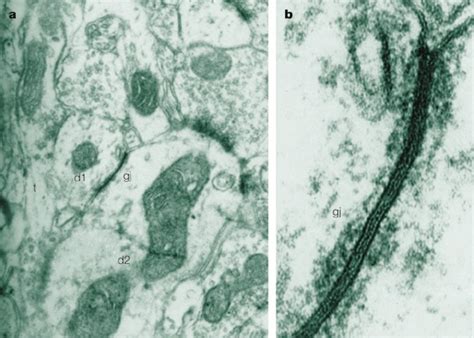 Gap Junctions Between Dendrites Of Inhibitory Neocortical Download Scientific Diagram