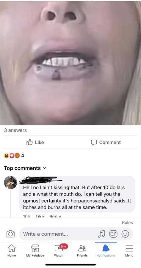 Tracy Has Herpes Rthehotnailladysnark