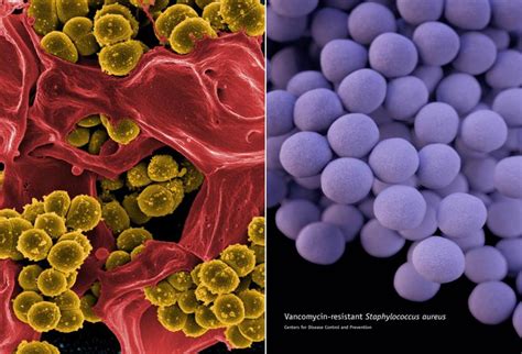 Multidrug Resistant Organisms Mdros Growing Spreading And Killing