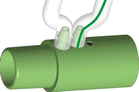 Reusable Flow Sensors And Expiration Valves Medacx
