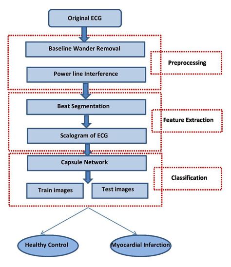 Myocardial Infarction Classification Process Download Scientific Diagram