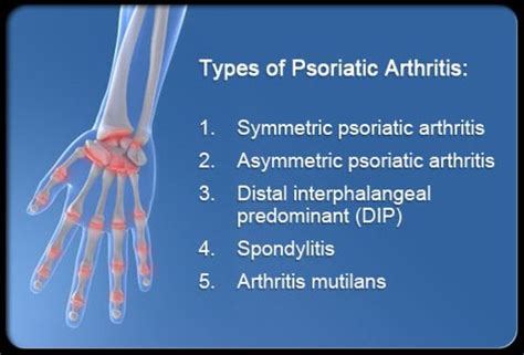 Symptoms Causes And Treatment Of Psoriatic Arthritis Healthproadvice
