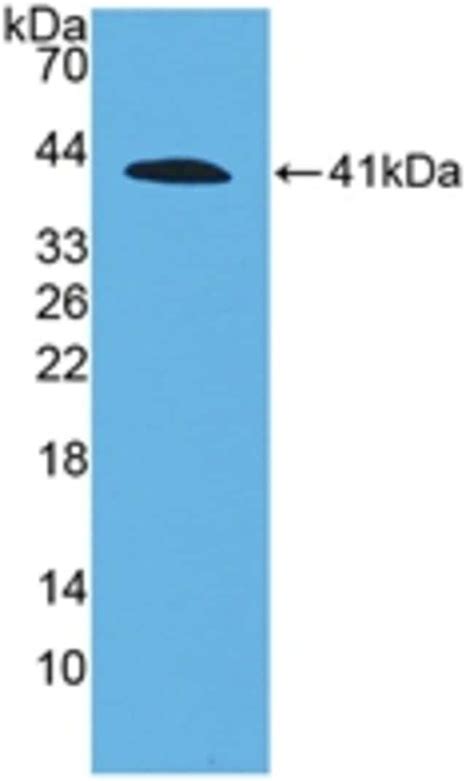 Complement C4a Polyclonal Antibody Invitrogenantibodiesprimary