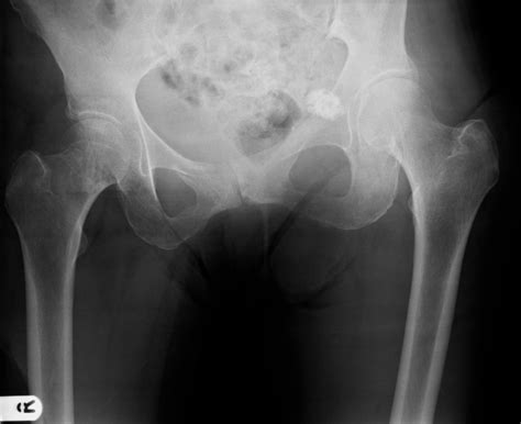 Test Yourself Regular Sets Set 19 Emergency Department Radiology Courses