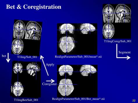 Ppt Data Processing And Analysis Of Resting State Fmri Powerpoint