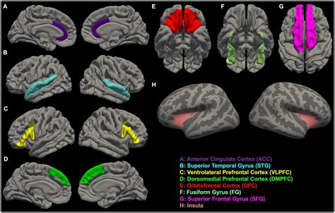 Frontiers Neuroimaging Alterations Of The Suicidal Brain And Its Relevance To Practice An