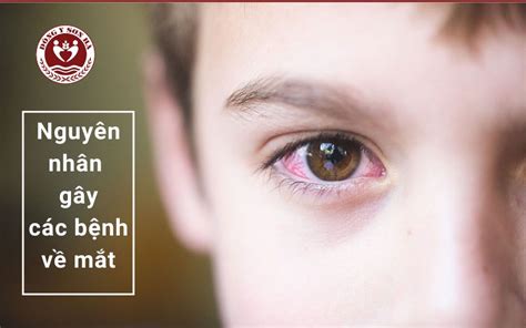 Mga Salik Na Nakakaapekto Sa Mga Mata Ang Mga Mata Ng Mga Bata Ay Kailangang Protektahan Upang