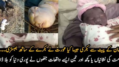 دنیا میں ہونے والے تین عجیب و غریب بچوں کی پیدائش کا واقعہ جنہوں نے