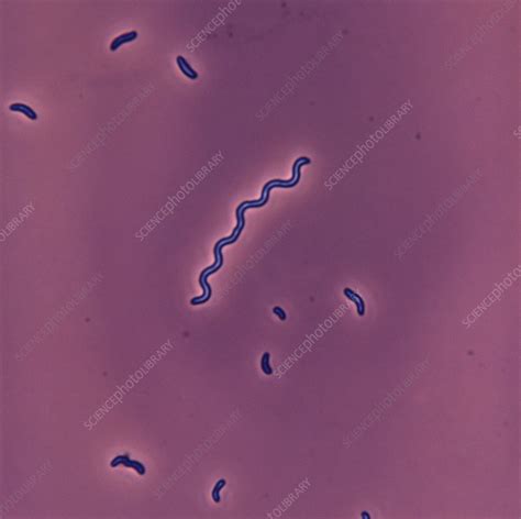 Nitrogen Fixing Bacteria Stock Image C017 4208 Science Photo Library