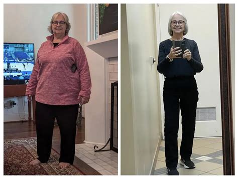 10 Incredible Zepbound Before And After Photos That Will Leave You