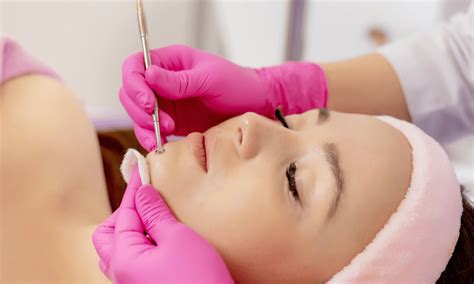 Acne Treatment Richmond Hill — Acuvega Wellness Center