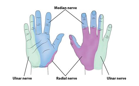 Median Nerve Block Sonoguide