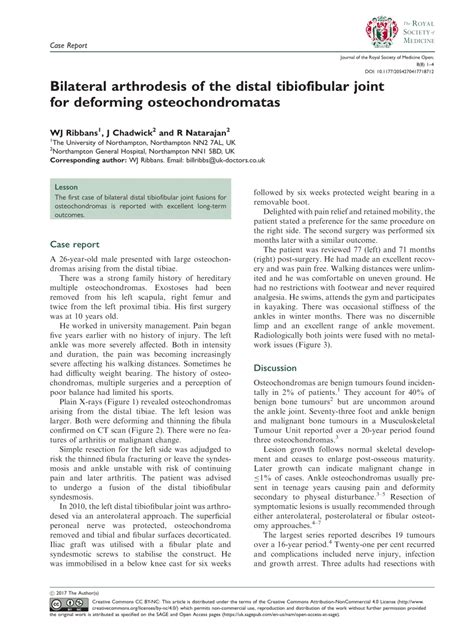 Pdf Bilateral Arthrodesis Of The Distal Tibiofibular Joint For Deforming Osteochondromatas
