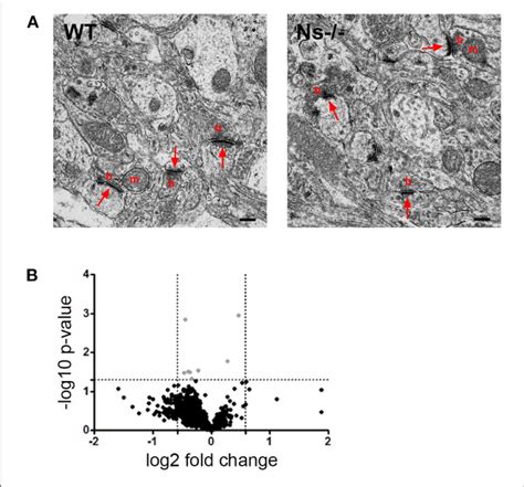 No Differences Were Detected In Neocortical Synapses Of Adult