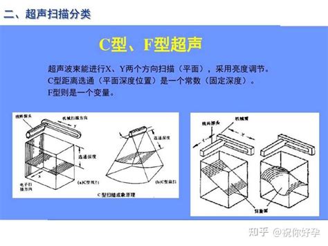 超声成像的基本原理 知乎