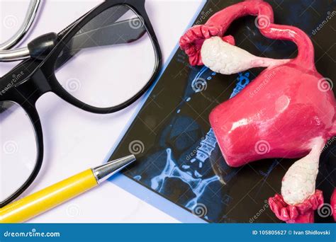 Mri Magnetic Resonance Imaging Of Uterus And Ovaries Model Of Uterus