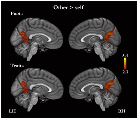 Involvement Of Cortical Midline Structures In The Processing Of