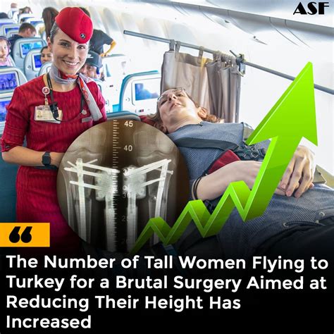 Amazing Clinics In Turkey Report Growing Demand For Height Reduction Surgery Where Femur