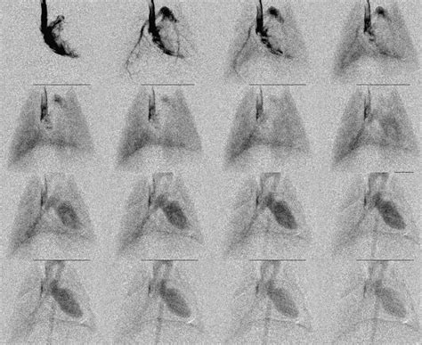 A Dsa Sequence Corresponding To A Single Injections And A Single Download Scientific Diagram