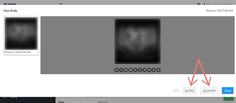 Advapacs Dicom Viewer Advapacs Docs