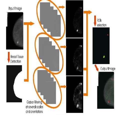 Scheme Of Gabor Filtering For Mass Detection Download Scientific Diagram