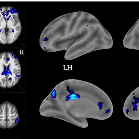 Pdf Dorsolateral Prefrontal Cortex Response To Negative Tweets Relates To Executive Functioning