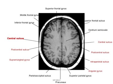 Intraparietal Sulcus Function