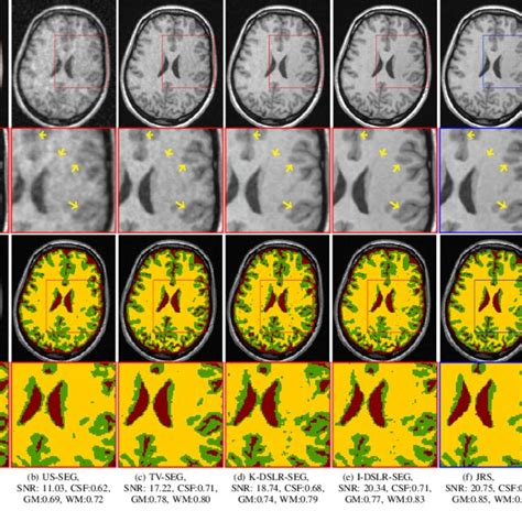 Comparison Of Reconstruction And Segmentation Quality Of Various Download Scientific Diagram