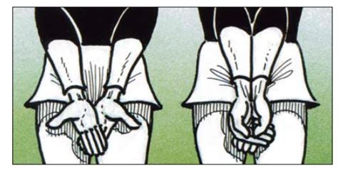 What Is The Correct Way To Hold Hands During Passing For Volleyball
