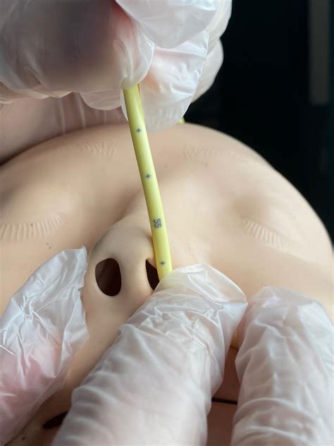 NG Insertion Osce Sense