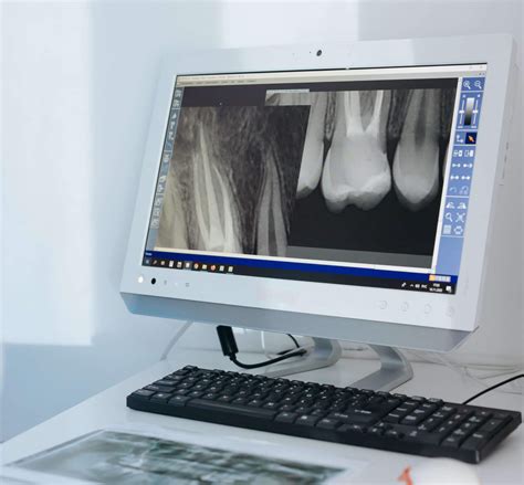 Endodontic Diagnoses To Know For The Inbde Inbde Bootcamp