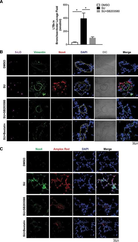 Leukotriene B4 Activates Pulmonary Artery Adventitial Fibroblasts In