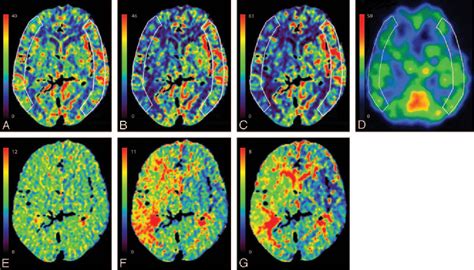 Figure 1 From Tracer Delayinsensitive Algorithm Can Improve