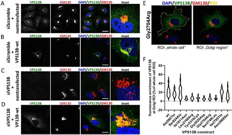 Golgi Enrichment Is Affected By Vps13b Missense Variants A D Golgi Download Scientific